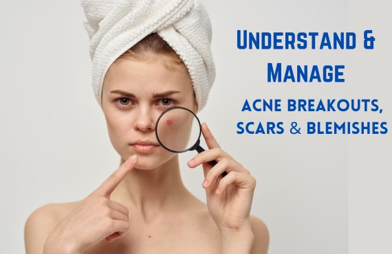 Managing Acne Breakouts, Scars, and Blemishes – Fidara Beauty
