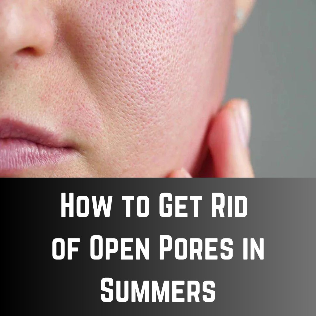 Simple Tips to Minimize Open Pores During the Summer – Fidara Beauty